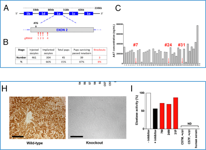 Mouse Model of Alpha-One Antitrypsin (AAT) Deficiency